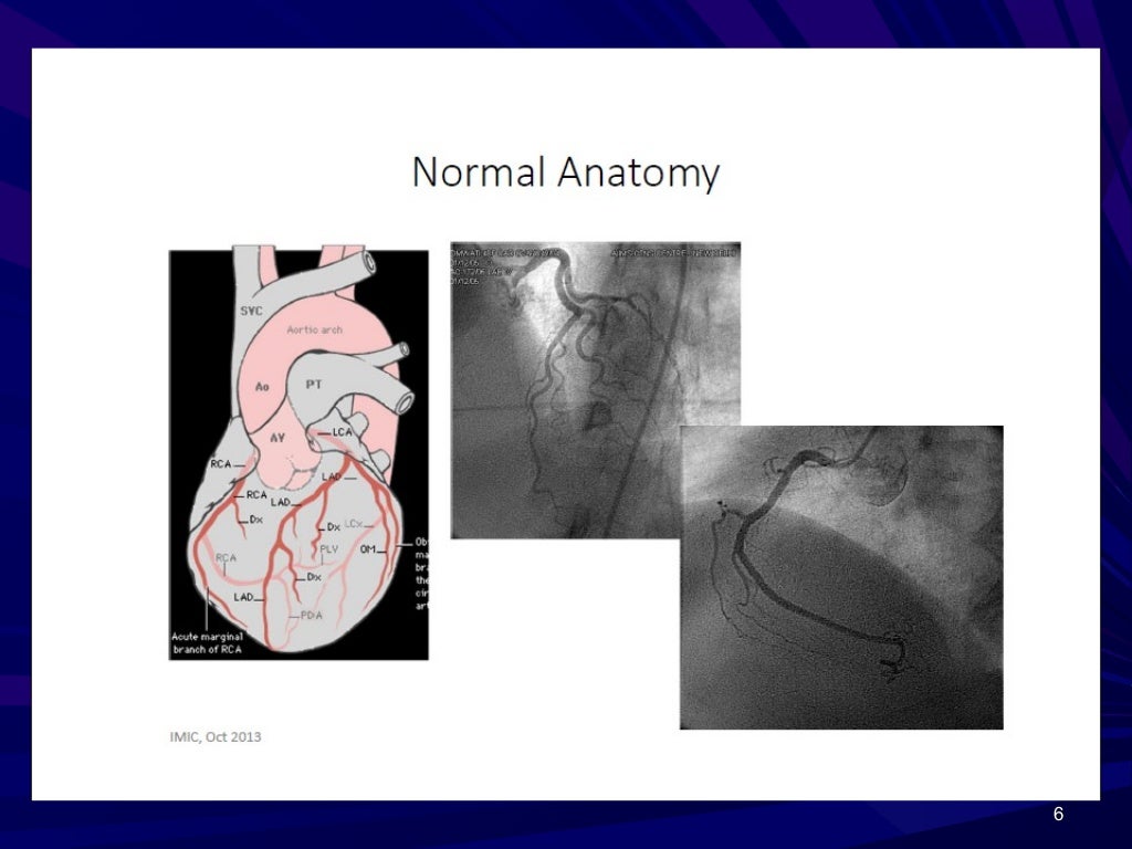 Interpretation of coronary angiogram
