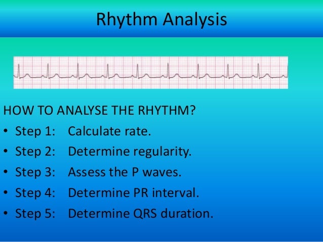 Interpretation of arrhythmias