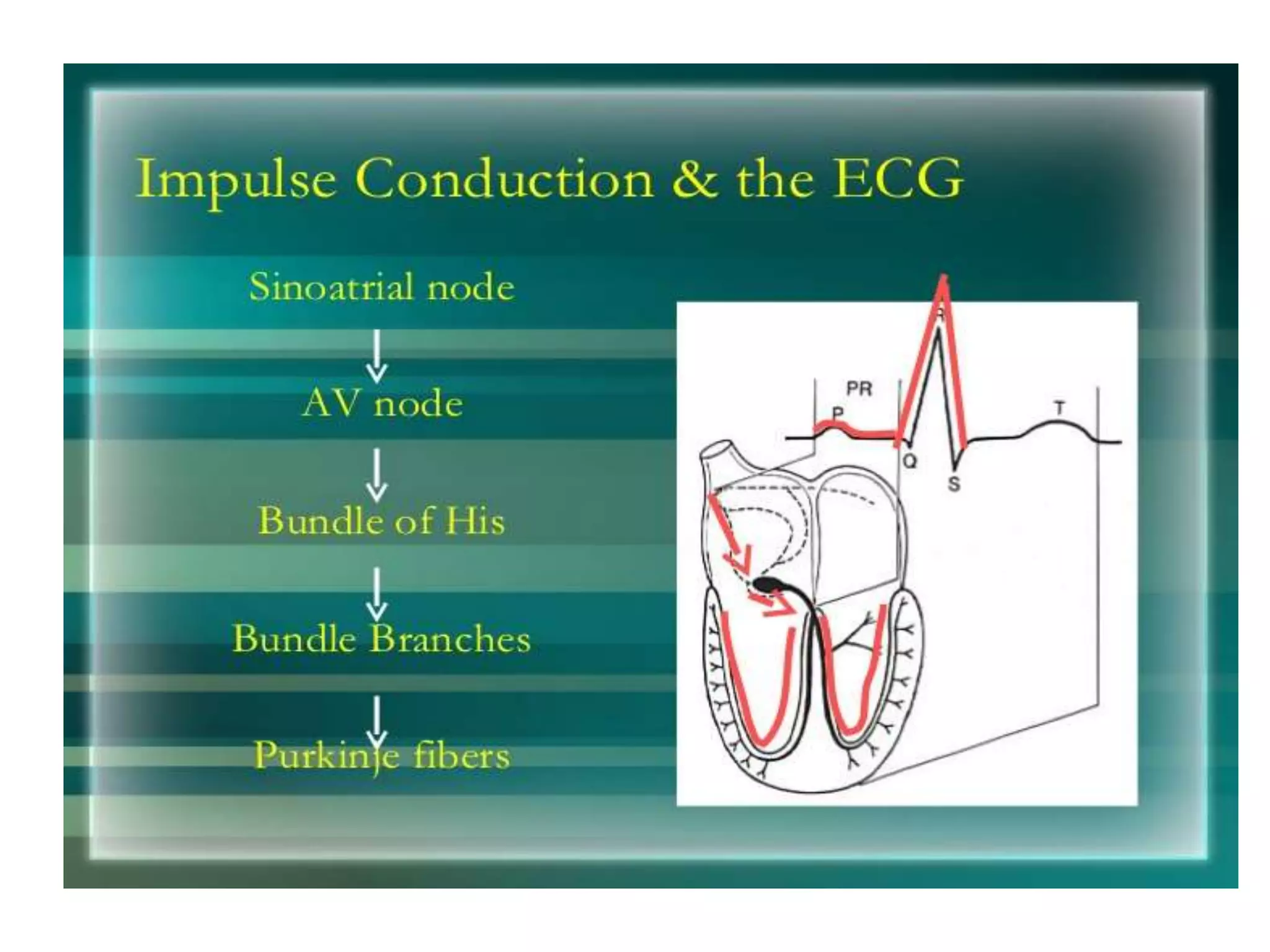 Interpretation of ecg_in_pulmonary_disease | PPTX