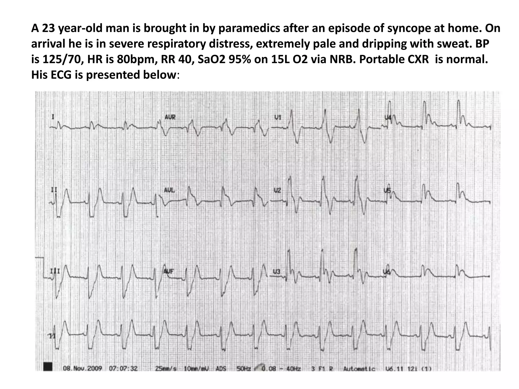 Interpretation of ecg_in_pulmonary_disease | PPTX