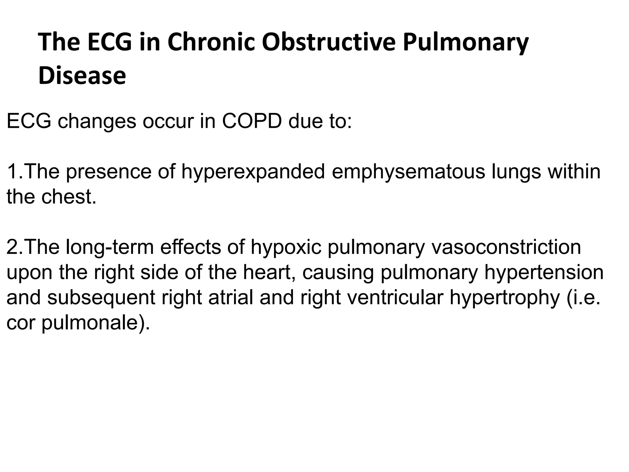 Interpretation of ecg_in_pulmonary_disease | PPTX