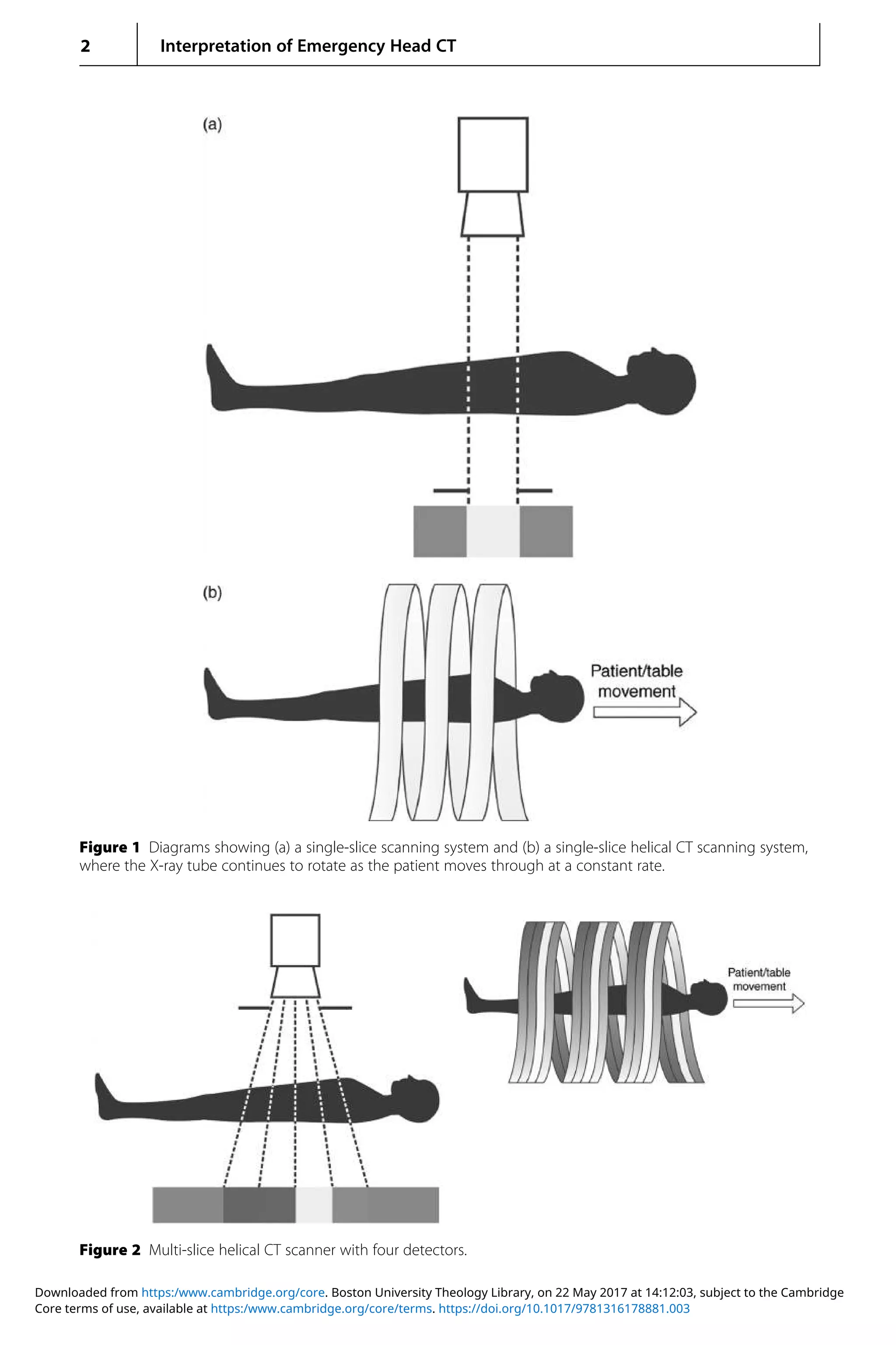 Interpretation of emergency head ct | PDF