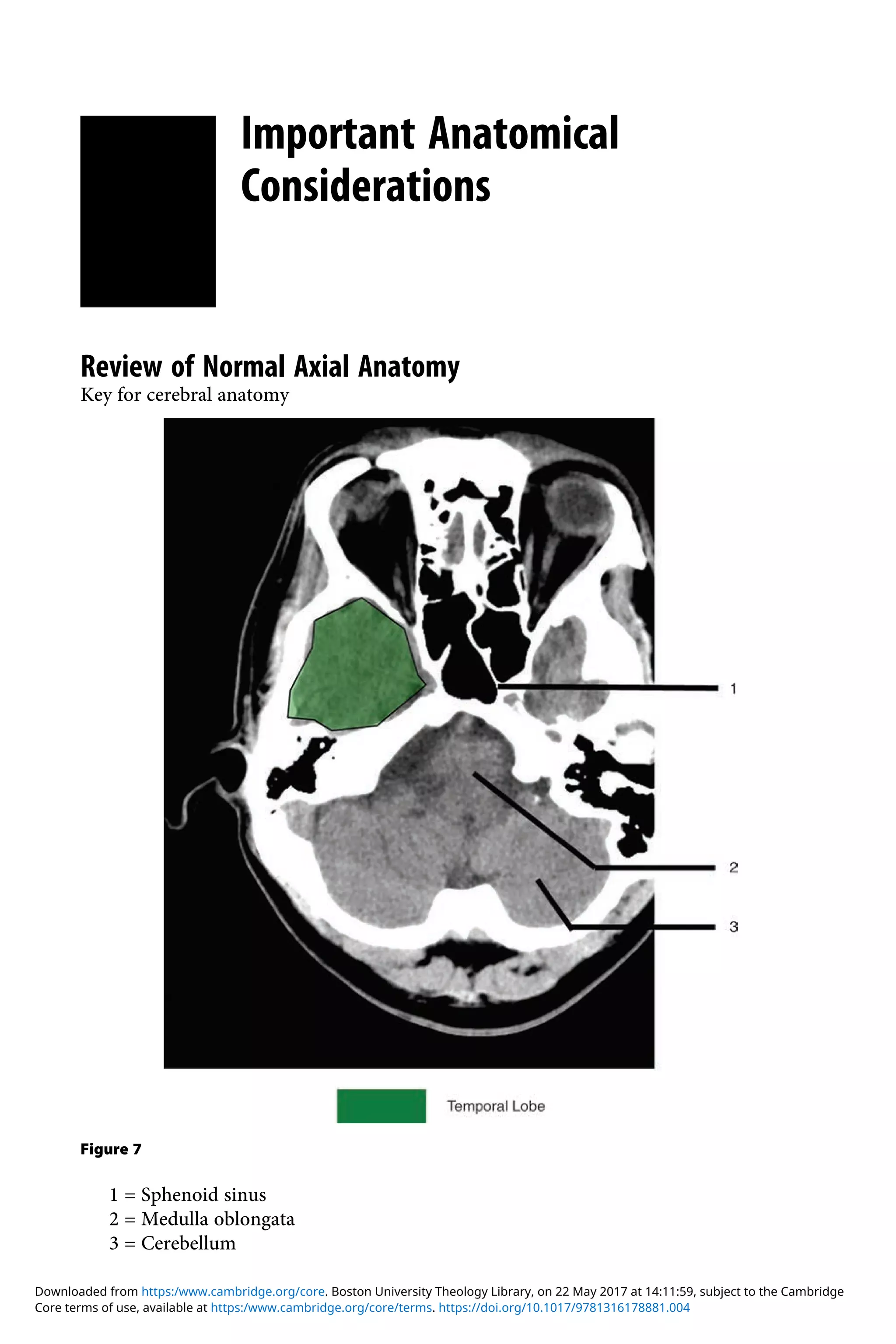Interpretation of emergency head ct | PDF