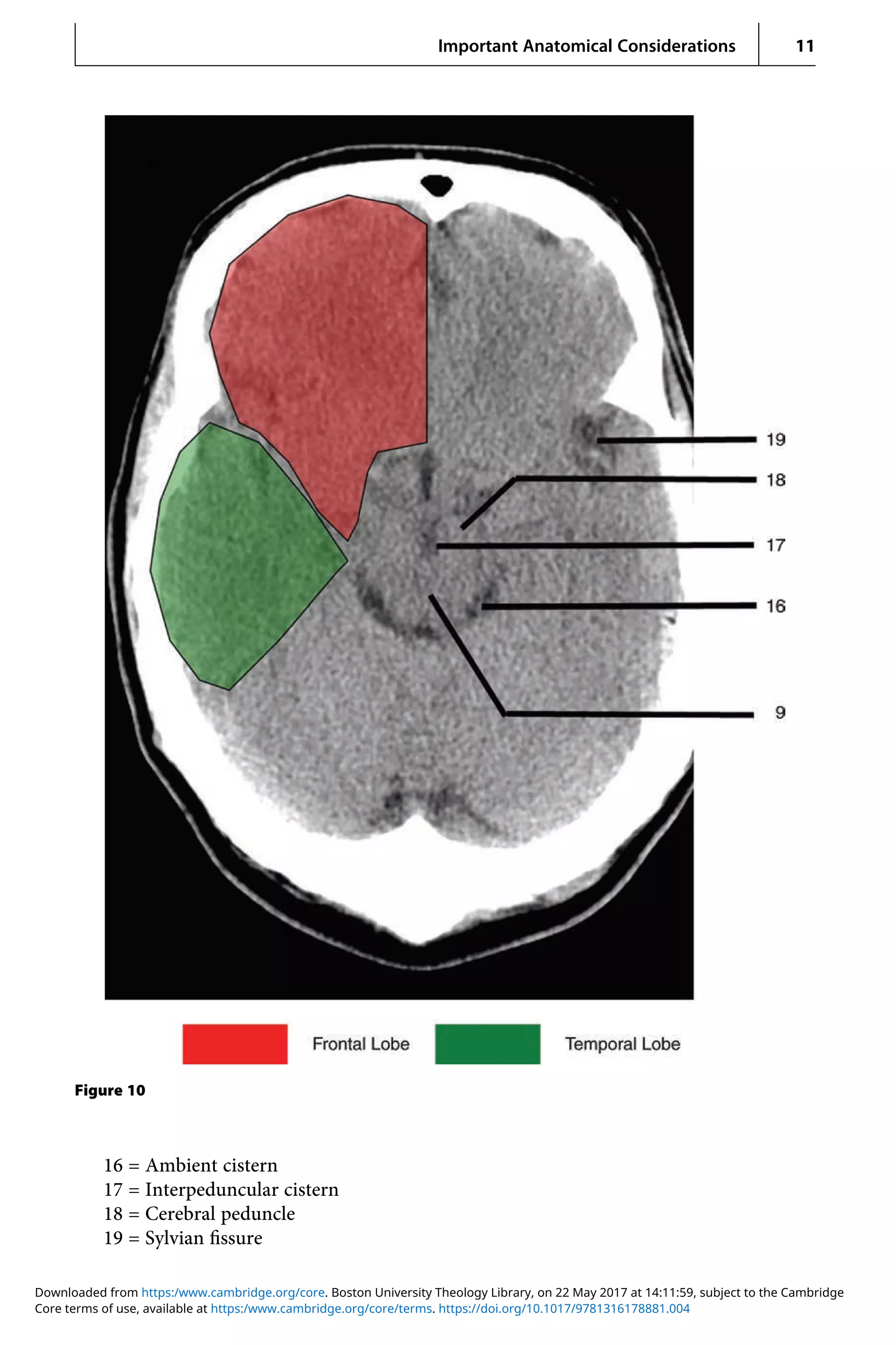 Interpretation of emergency head ct | PDF