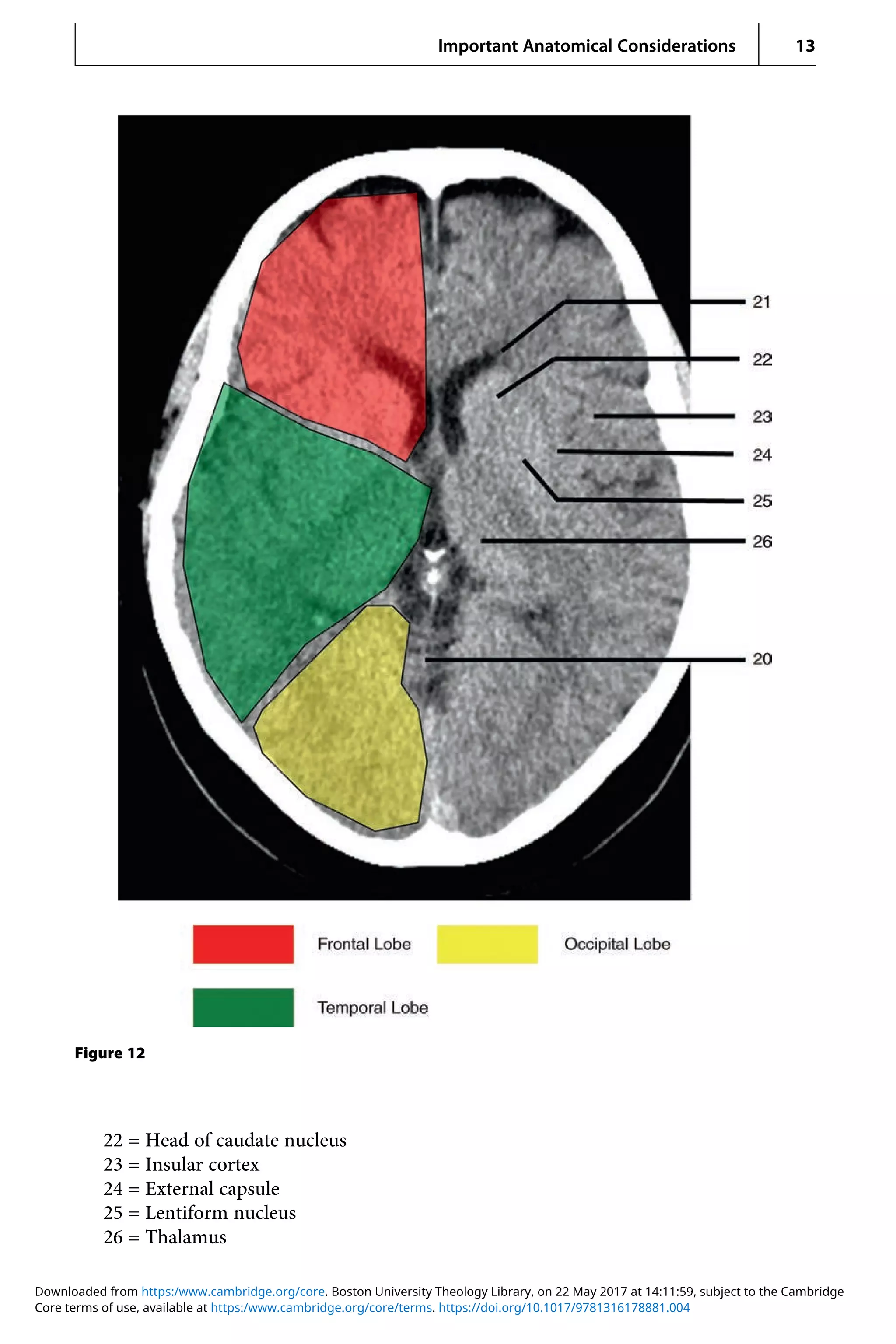 Interpretation of emergency head ct | PDF