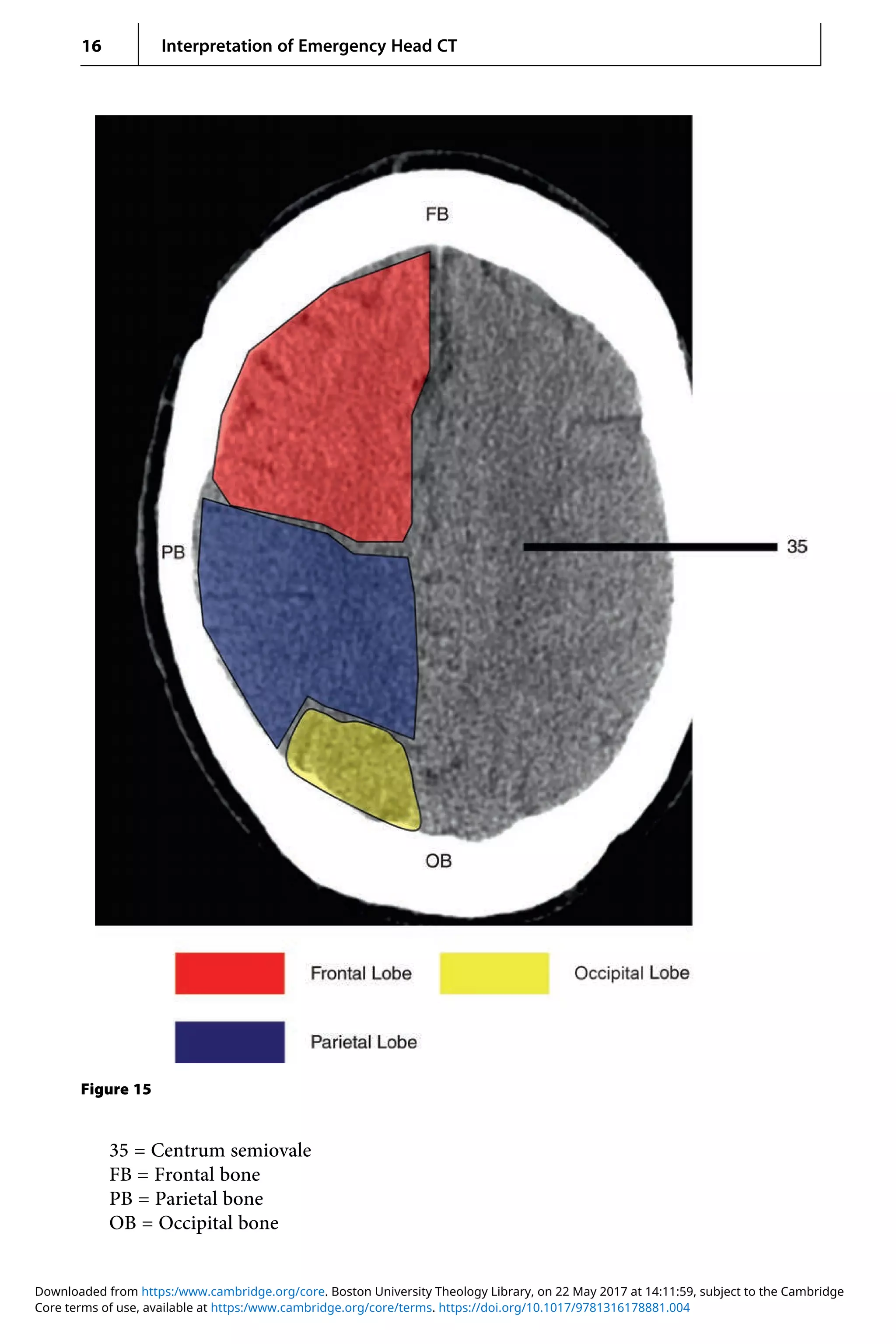 Interpretation of emergency head ct | PDF
