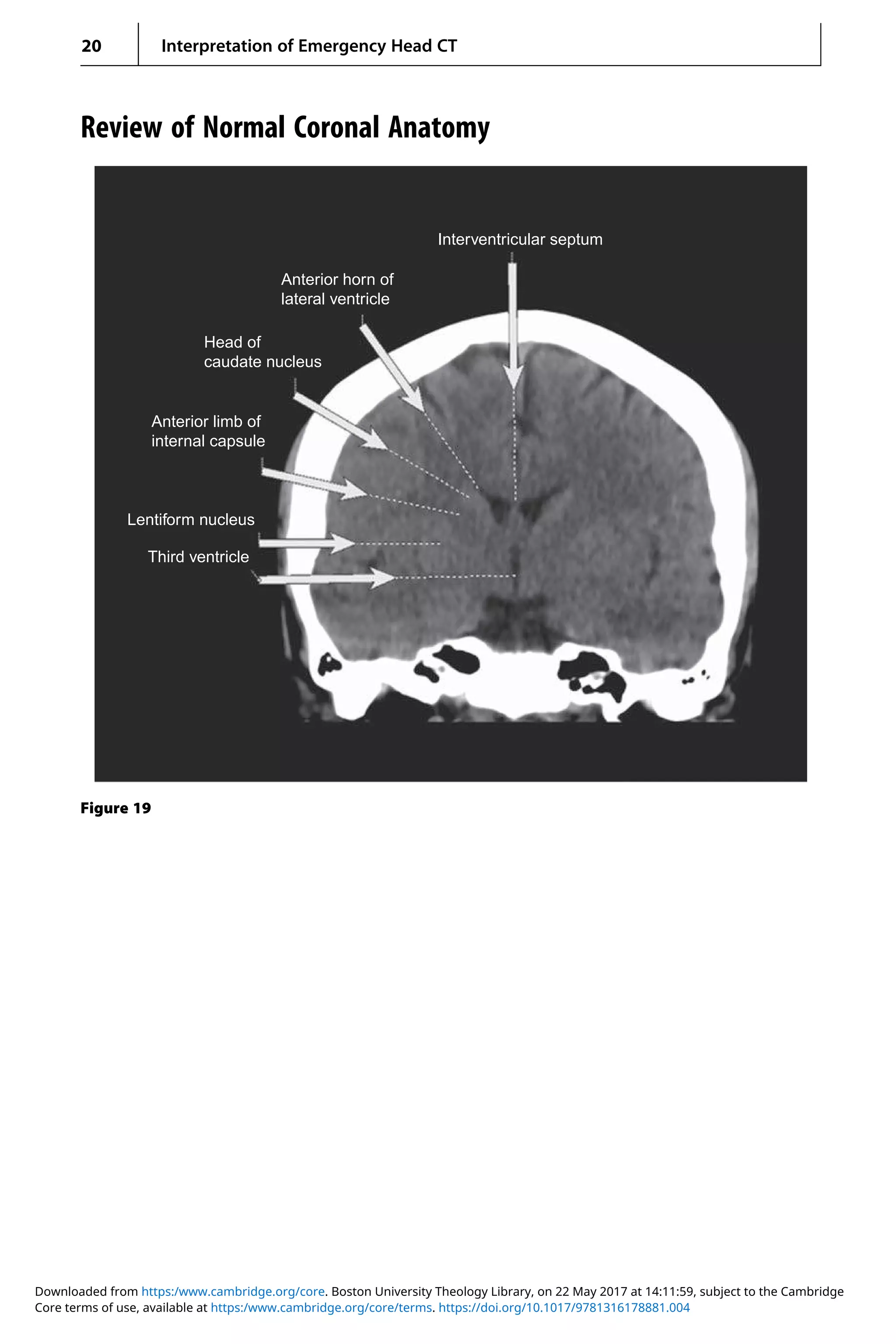 Interpretation of emergency head ct | PDF