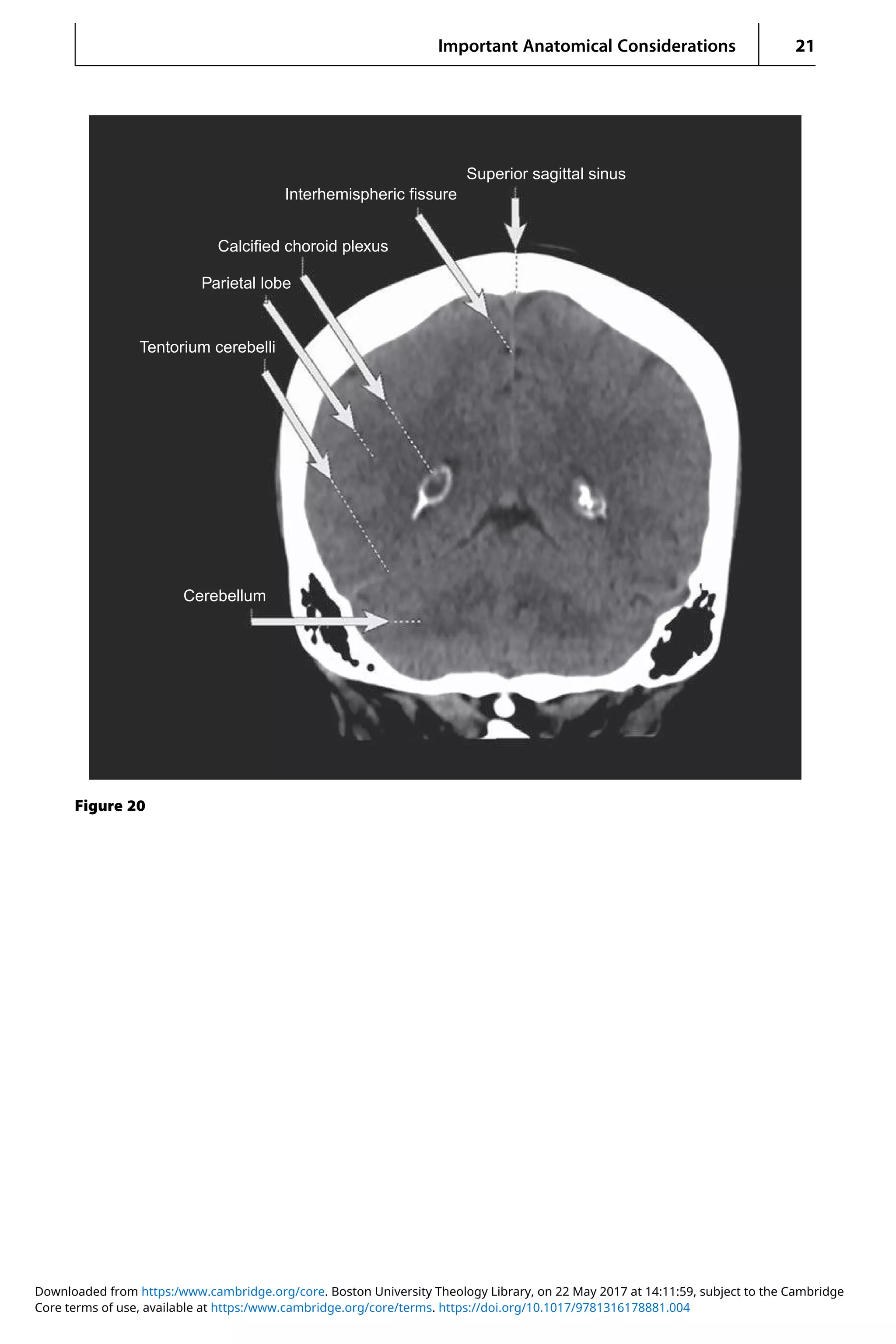 Interpretation of emergency head ct | PDF