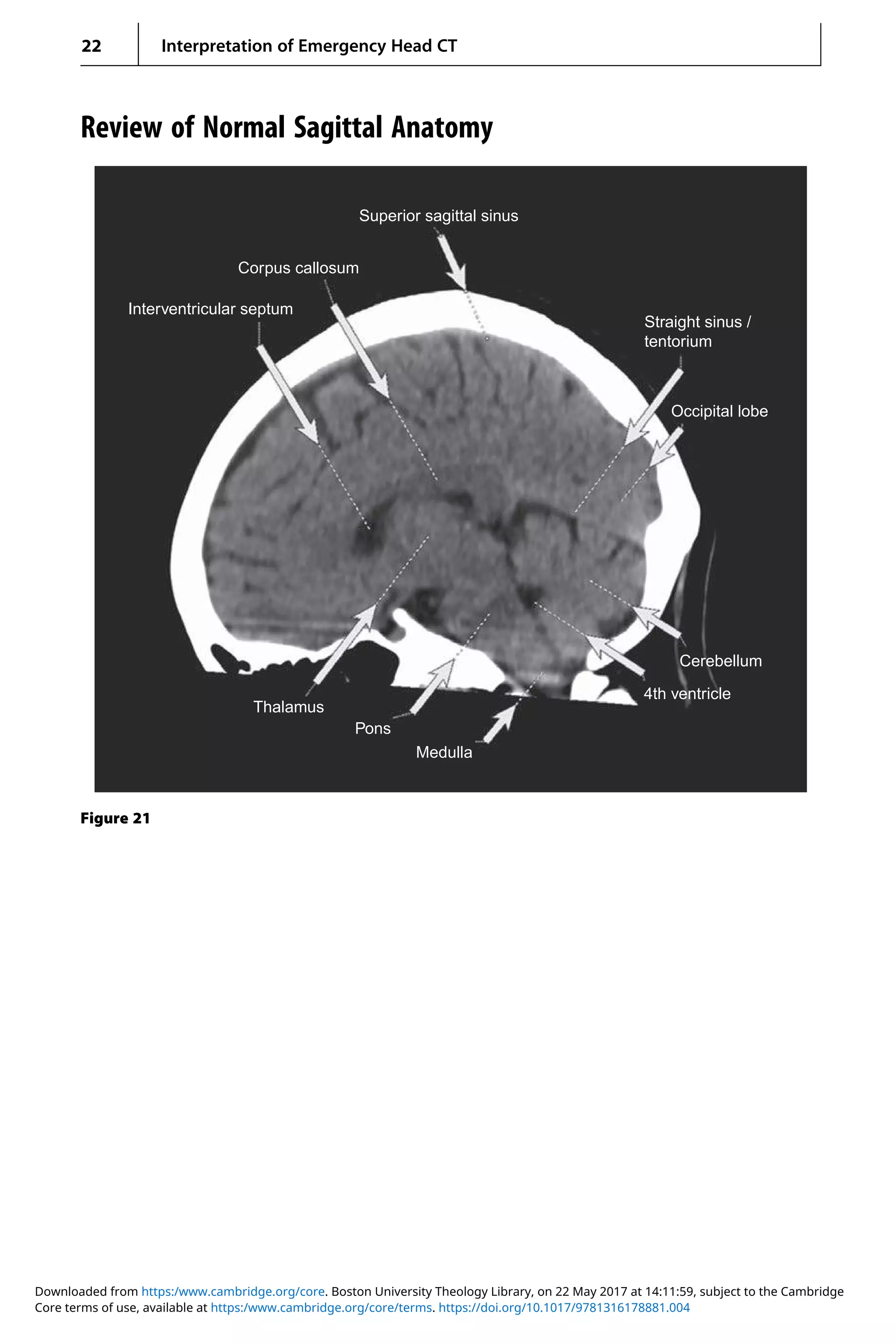 Interpretation of emergency head ct | PDF