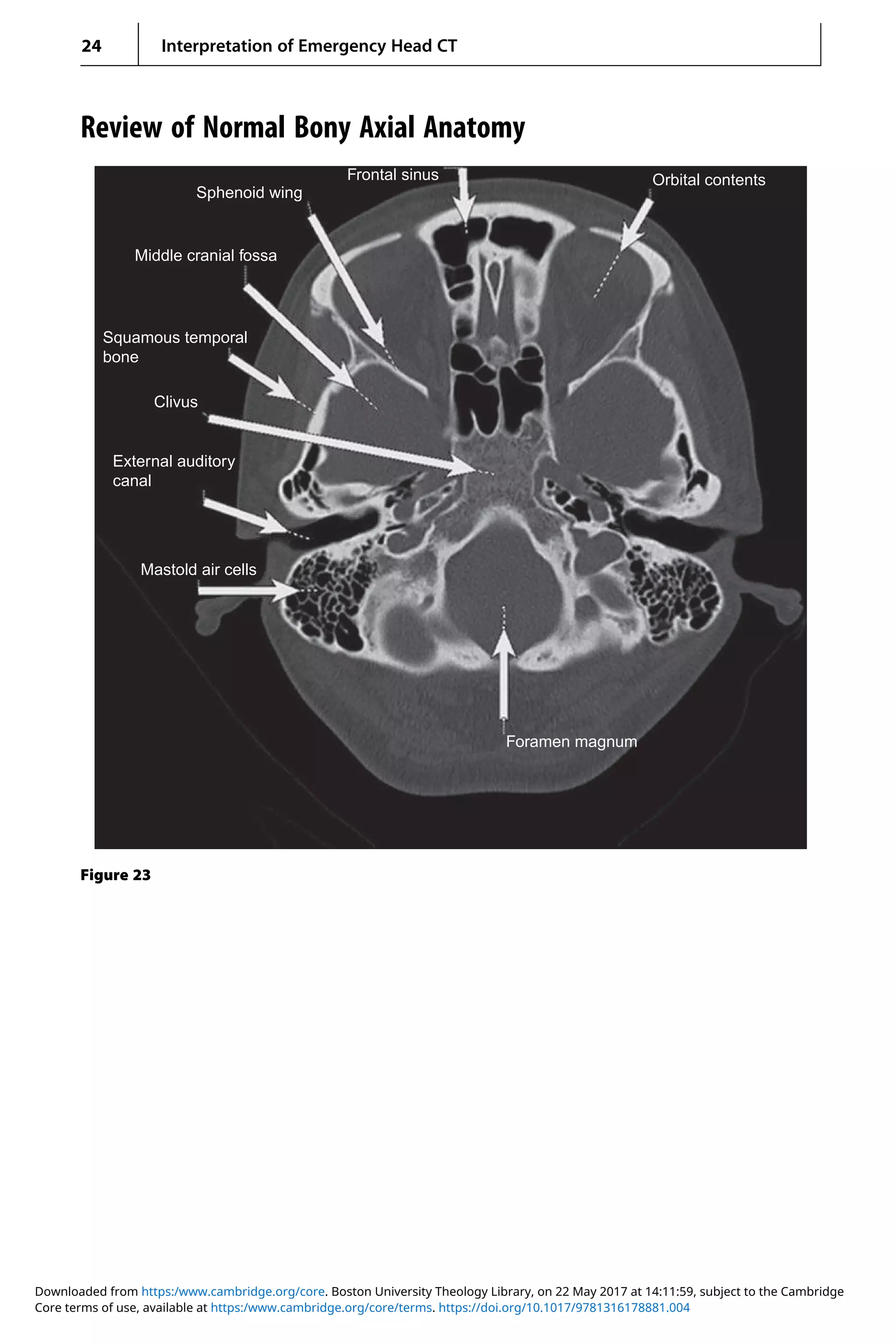 Interpretation of emergency head ct | PDF