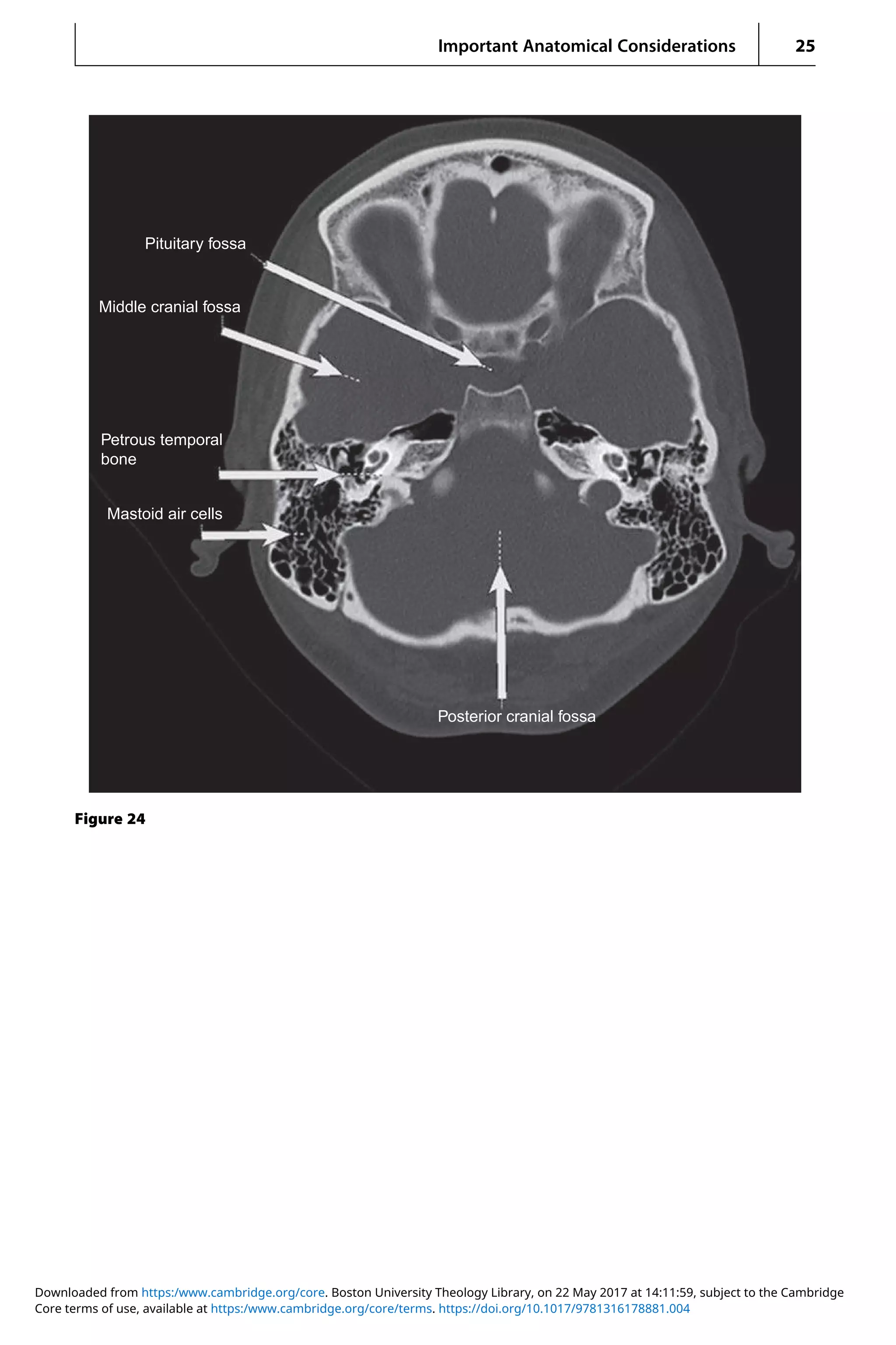 Interpretation of emergency head ct | PDF
