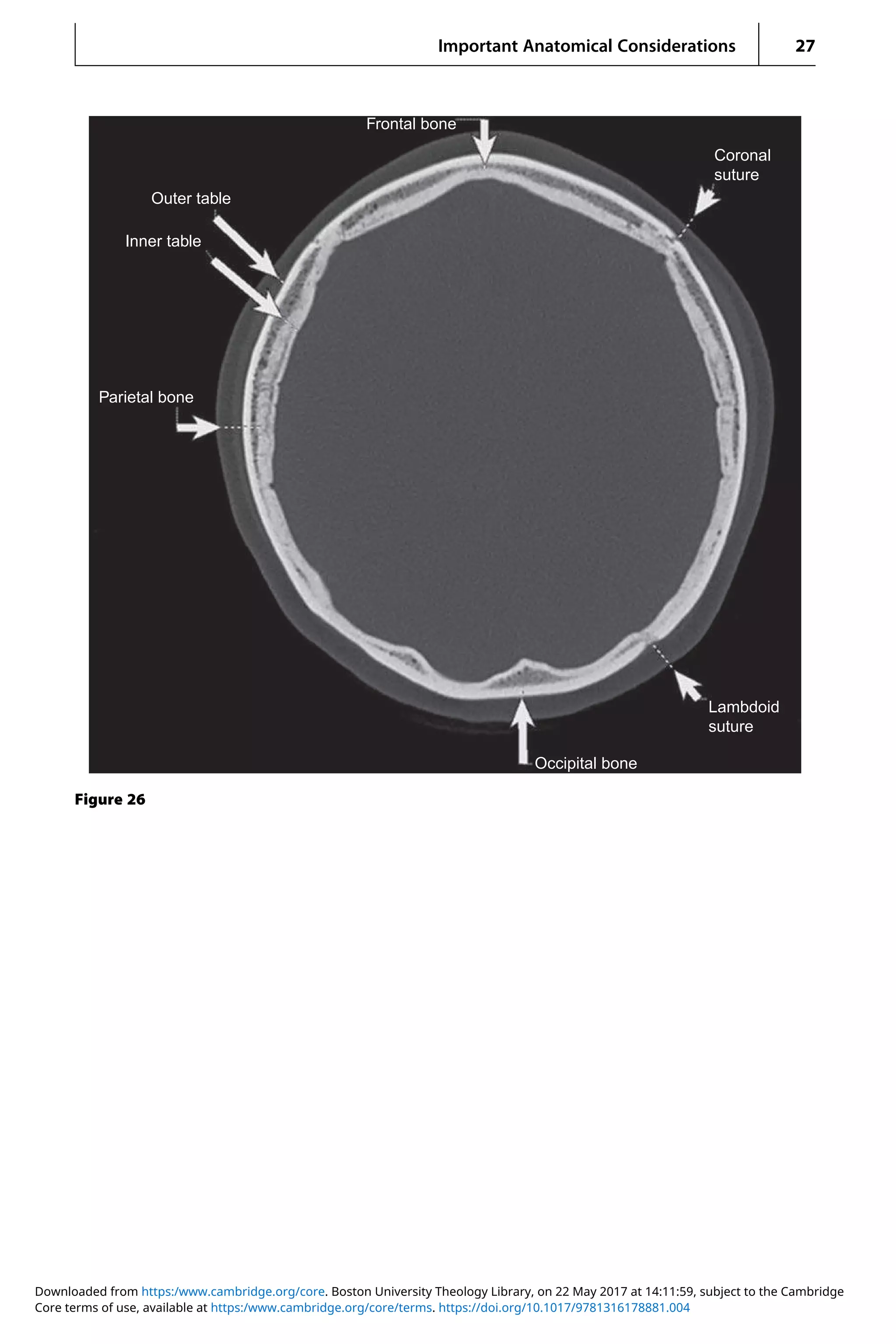 Interpretation of emergency head ct | PDF