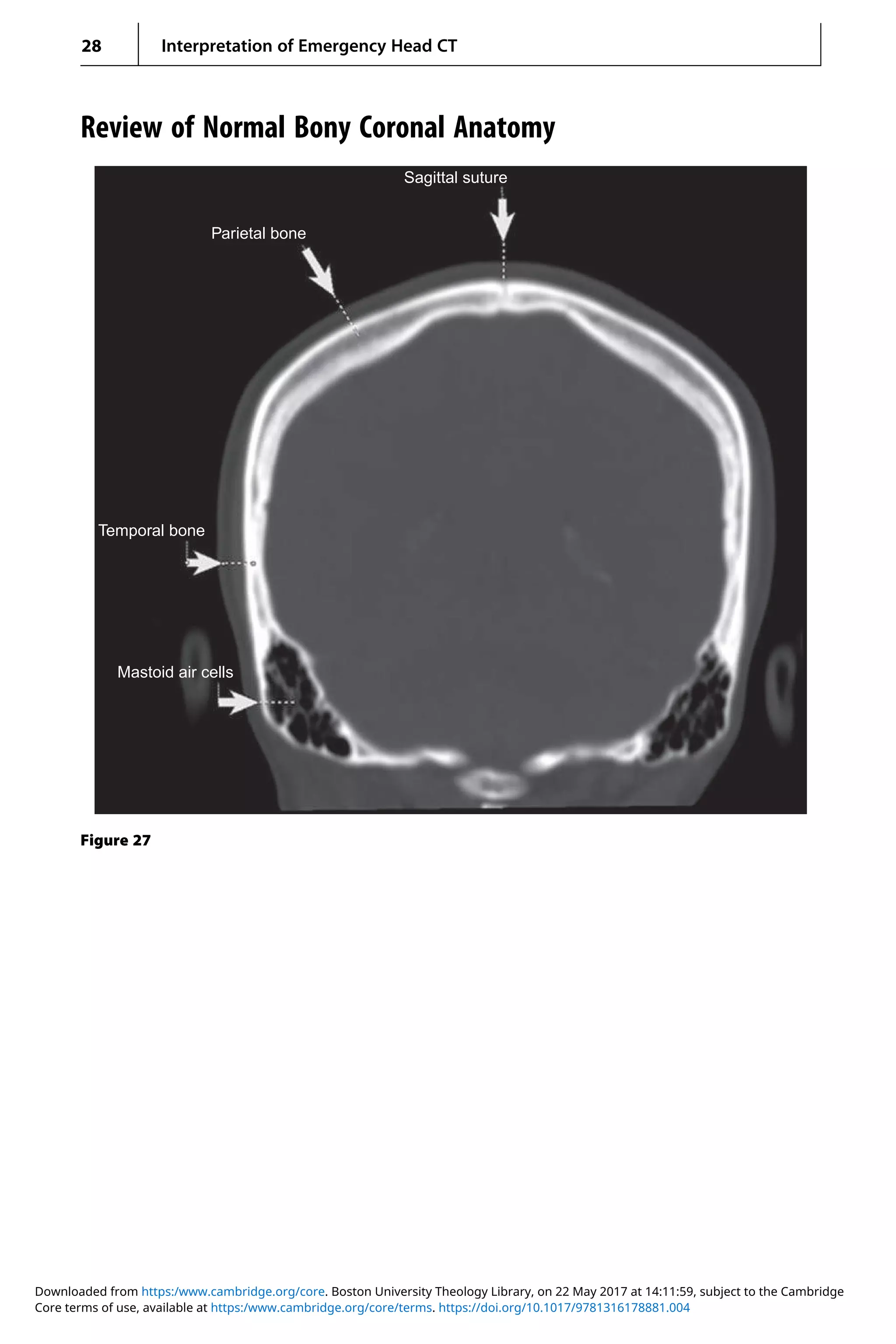 Interpretation of emergency head ct | PDF