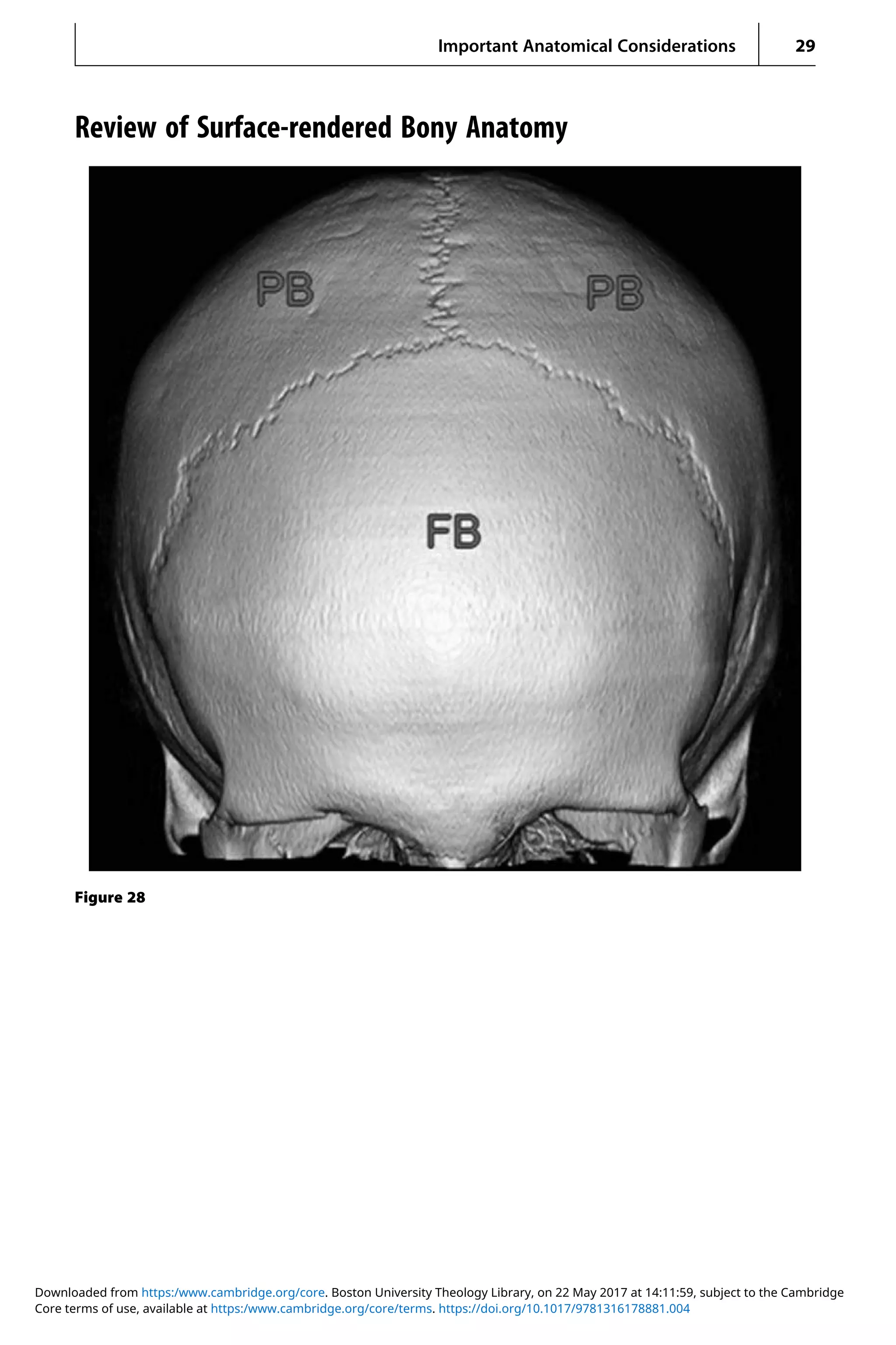 Interpretation of emergency head ct | PDF