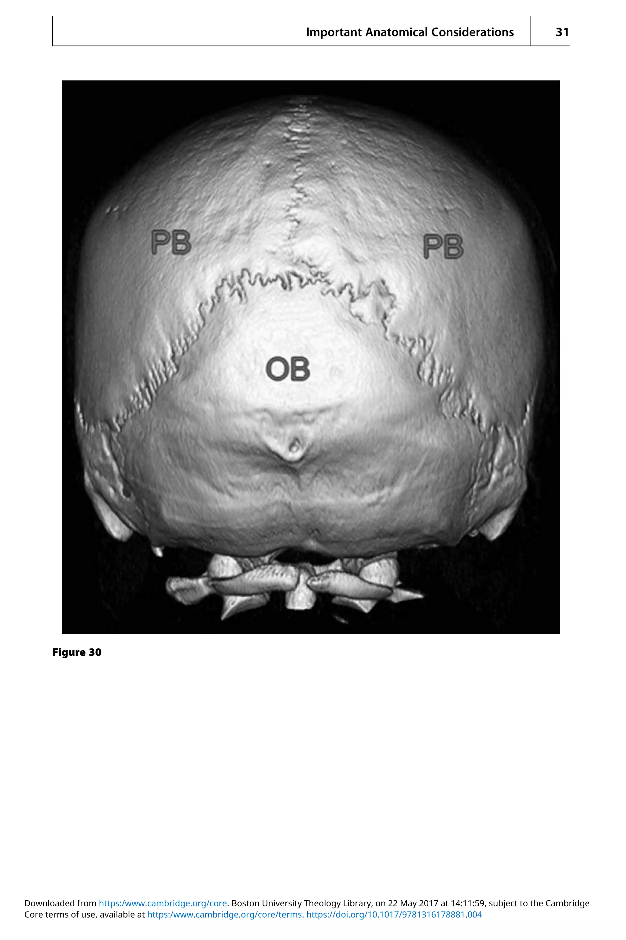 Interpretation of emergency head ct | PDF