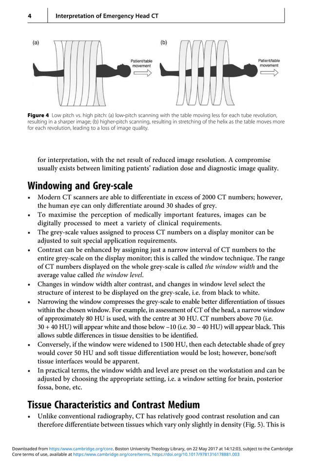 Interpretation of emergency head ct | PDF