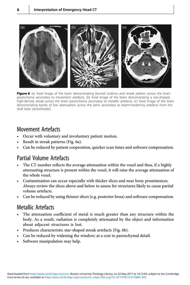 Interpretation of emergency head ct | PDF