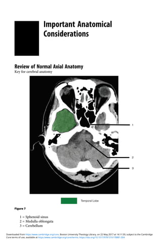 Interpretation of emergency head ct | PDF