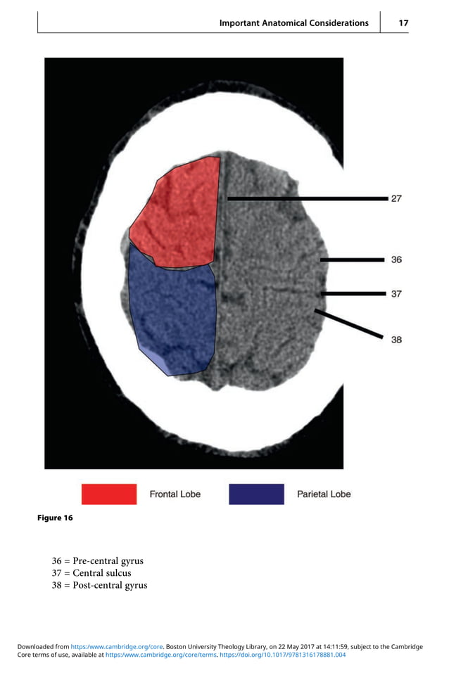 Interpretation of emergency head ct | PDF