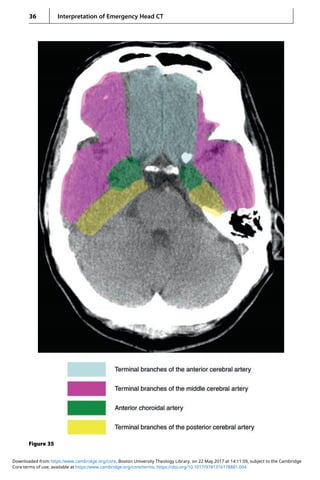 Interpretation of emergency head ct | PDF