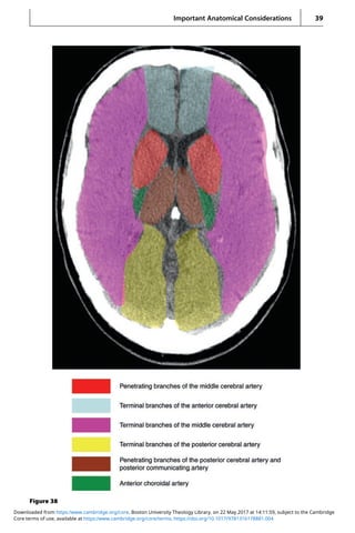 Interpretation of emergency head ct | PDF