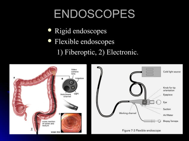 Interpretation of endoscopic gastrointestinal biopsy | PPT | Digestive ...