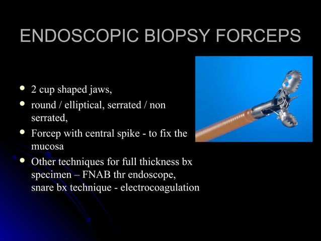 Interpretation of endoscopic gastrointestinal biopsy | PPT | Digestive ...