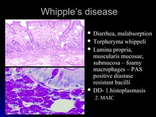 Interpretation of endoscopic gastrointestinal biopsy | PPT