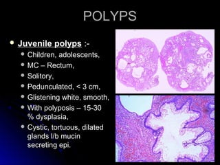 Interpretation of endoscopic gastrointestinal biopsy | PPT