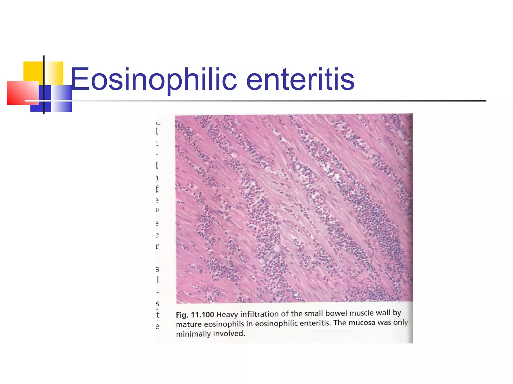 Interpretation of endoscopic intestinal biopsy | PPT