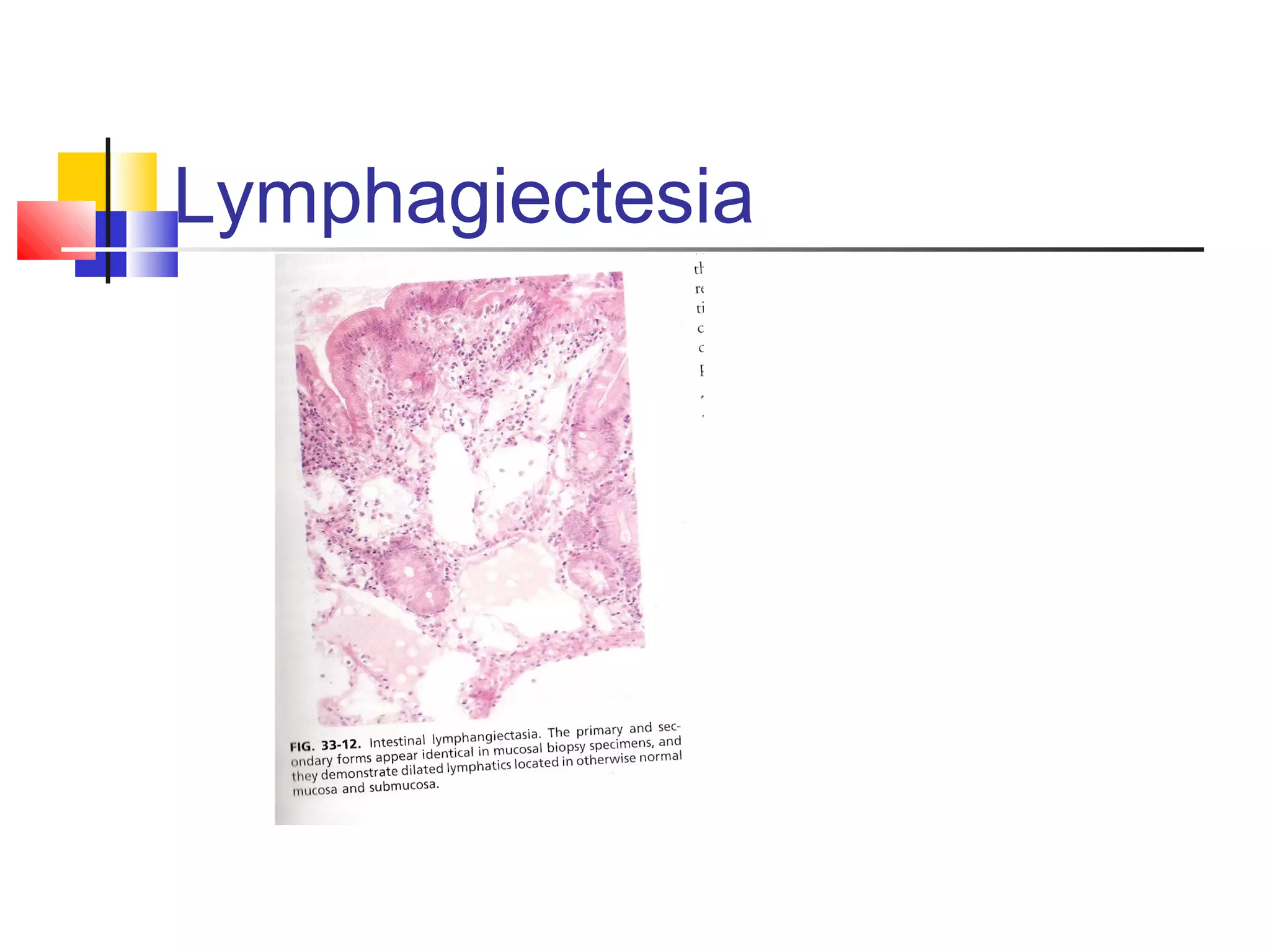 Interpretation of endoscopic intestinal biopsy | PPT