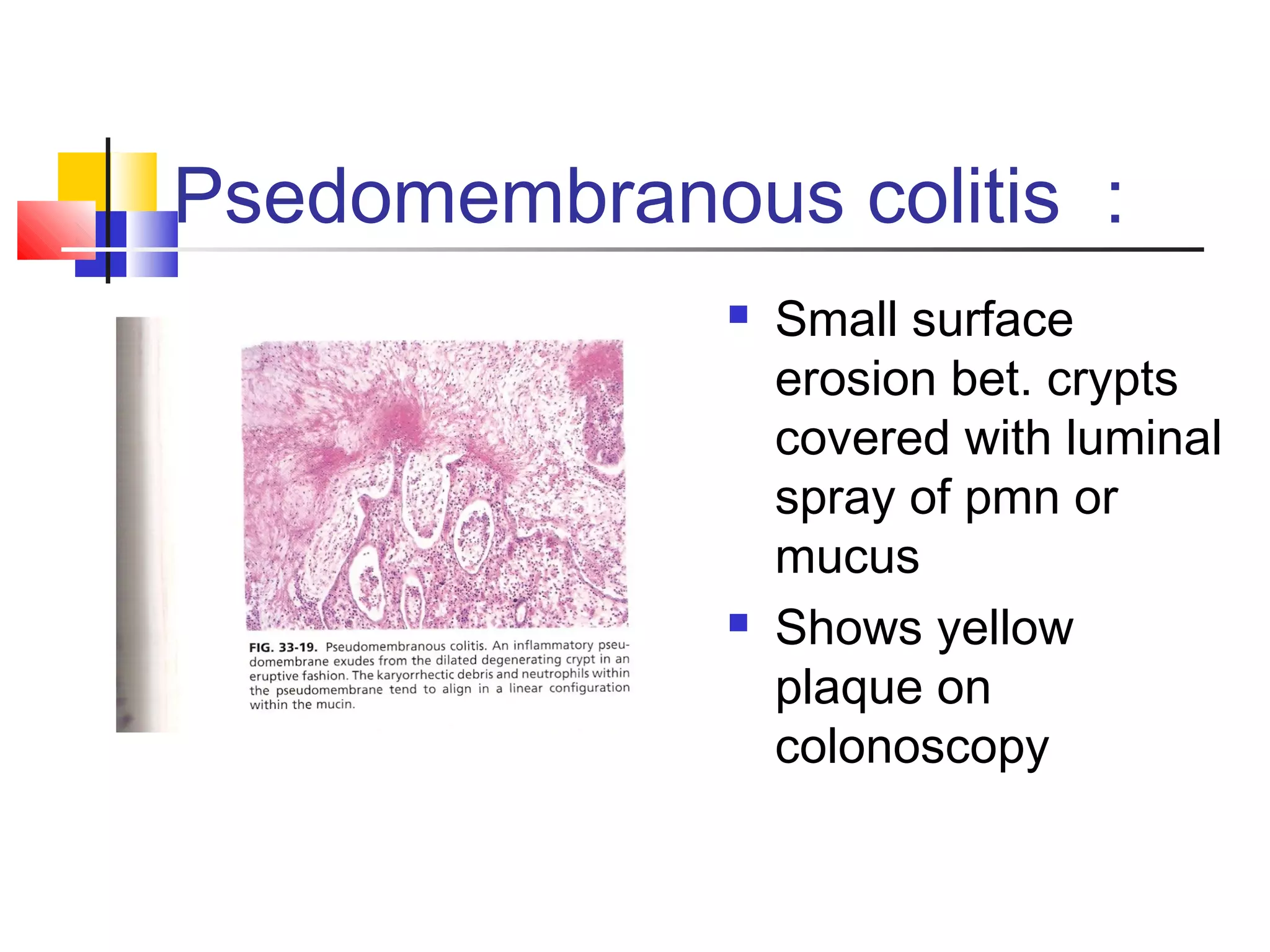 Interpretation of endoscopic intestinal biopsy | PPT
