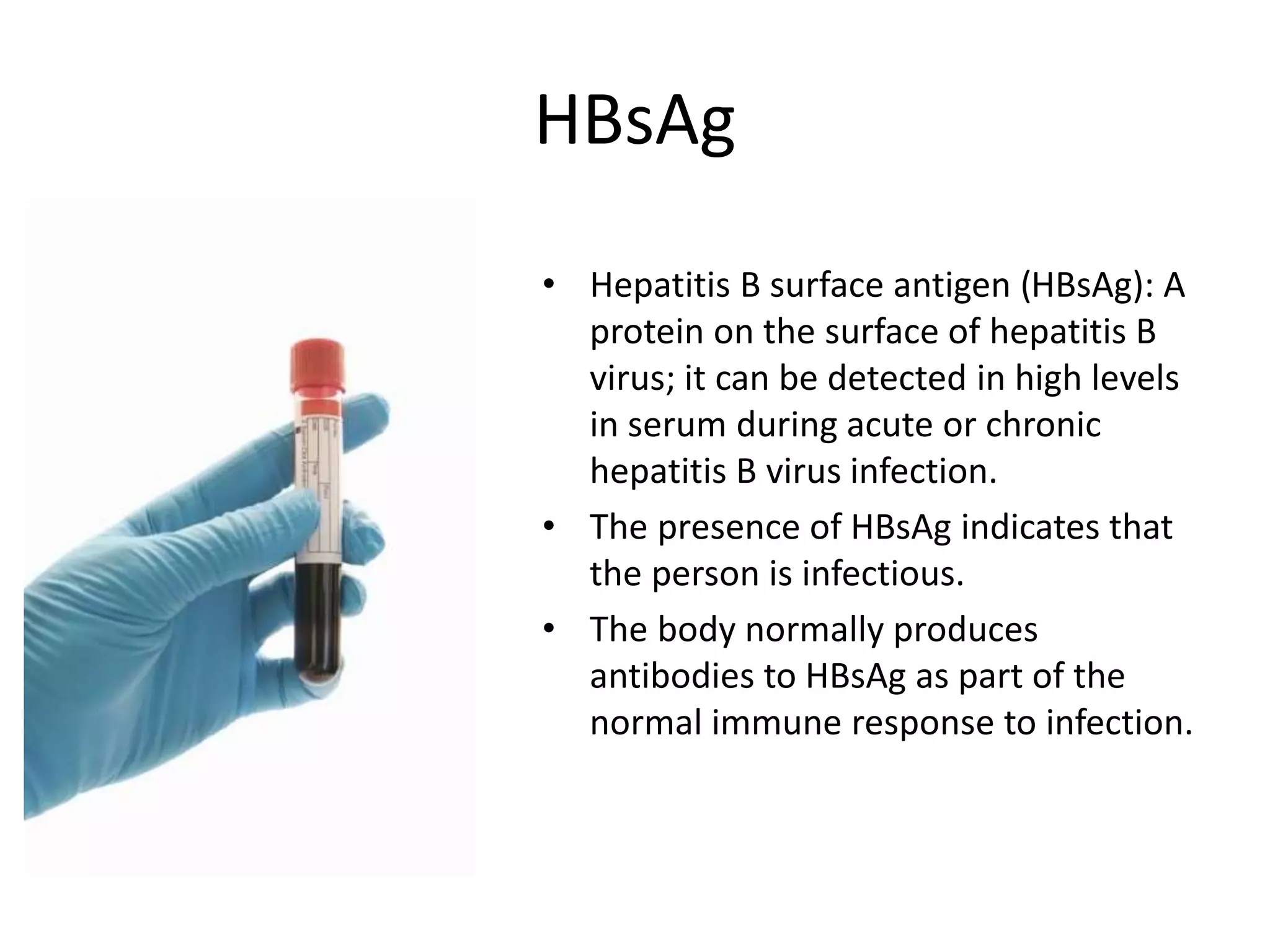 Interpretation of Hepatitis B Serologic Test Results | PPTX