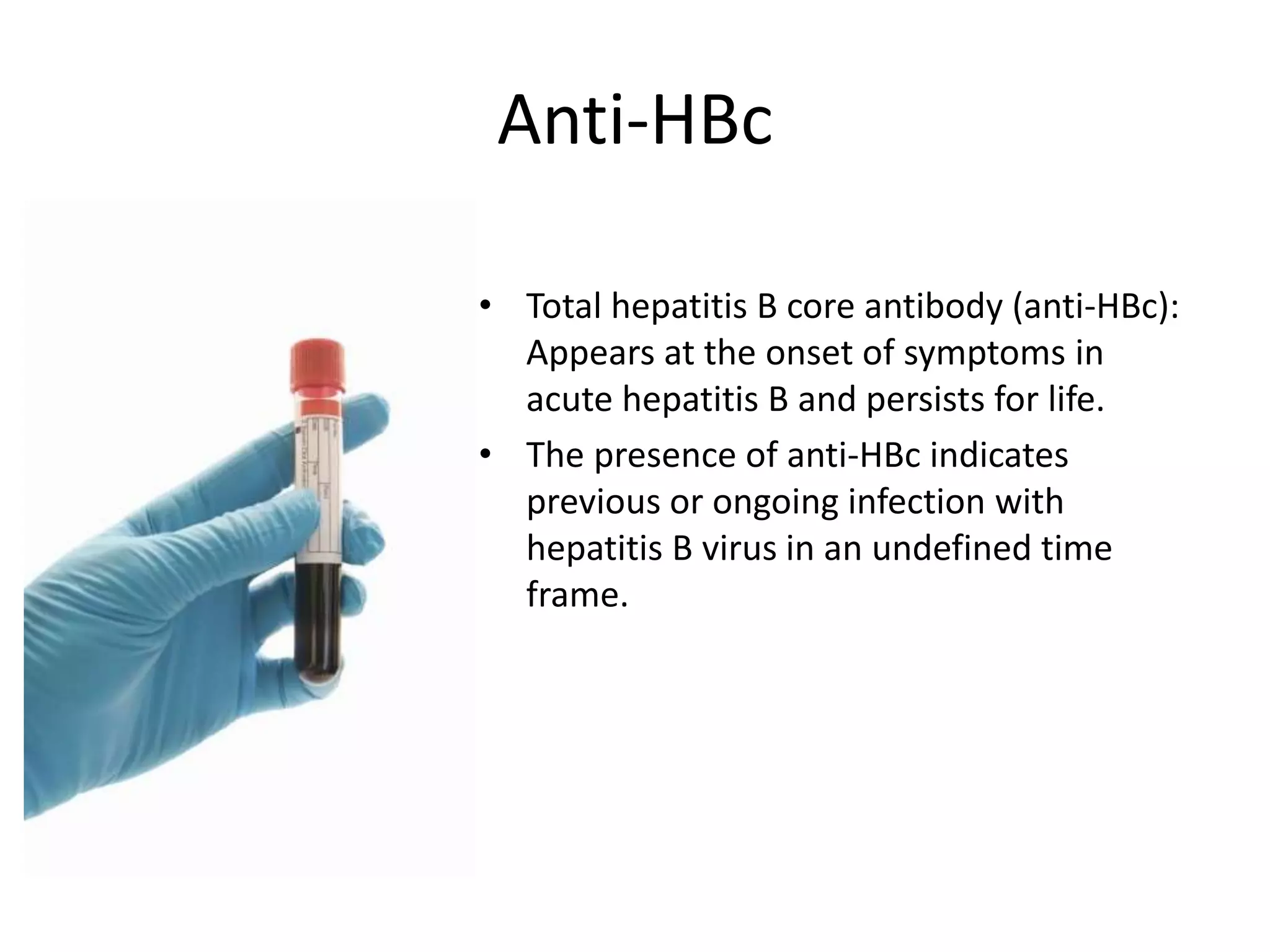 Interpretation of Hepatitis B Serologic Test Results | PPTX
