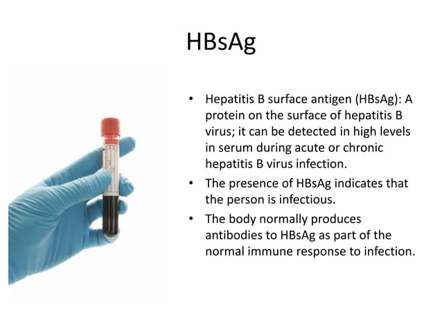 Interpretation of Hepatitis B Serologic Test Results | PPTX ...