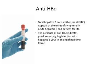 Interpretation of Hepatitis B Serologic Test Results | PPTX