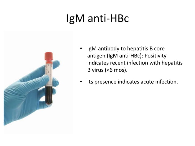 Interpretation of Hepatitis B Serologic Test Results | PPTX ...