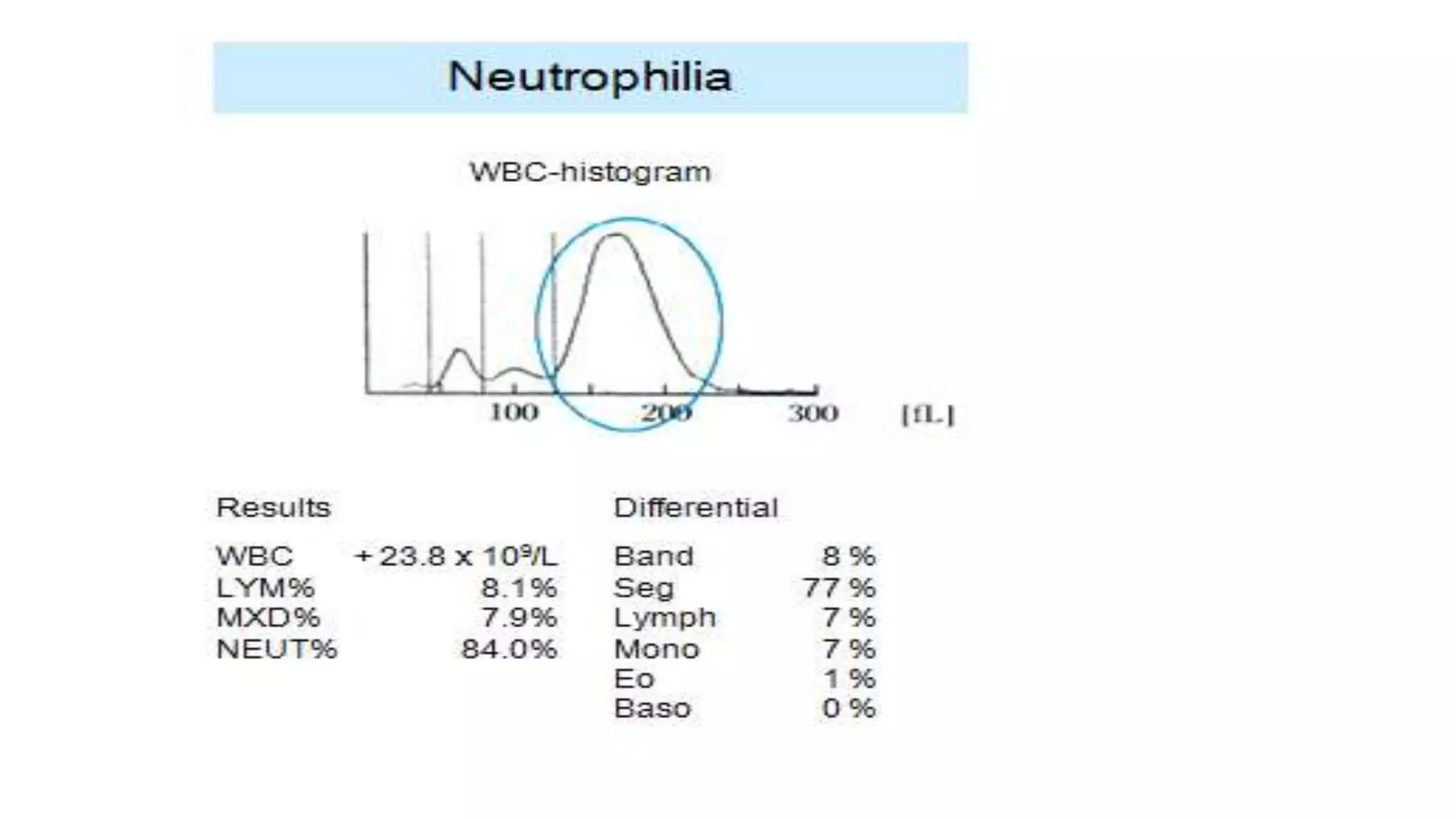 Interpretation of histograms | PPTX