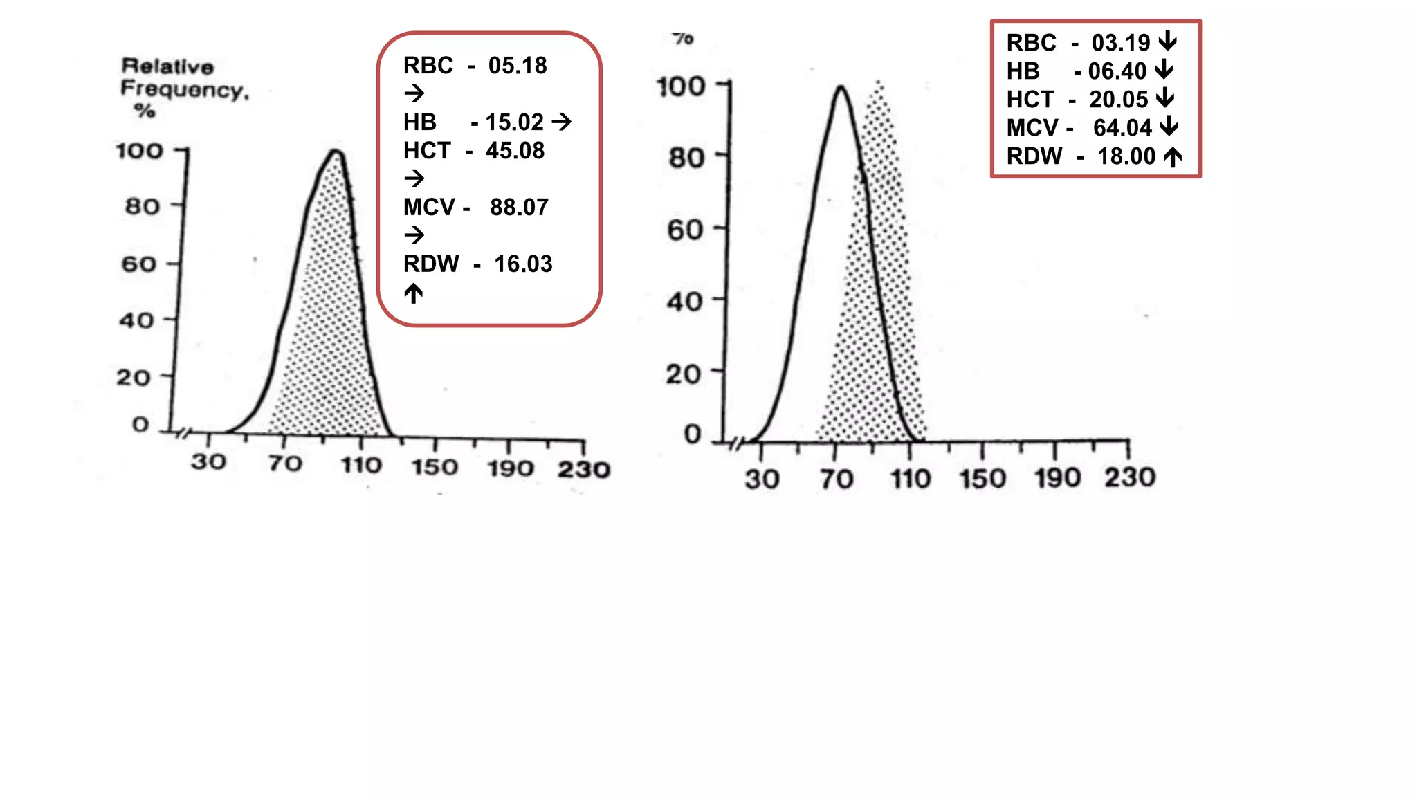 Interpretation of histograms | PPTX