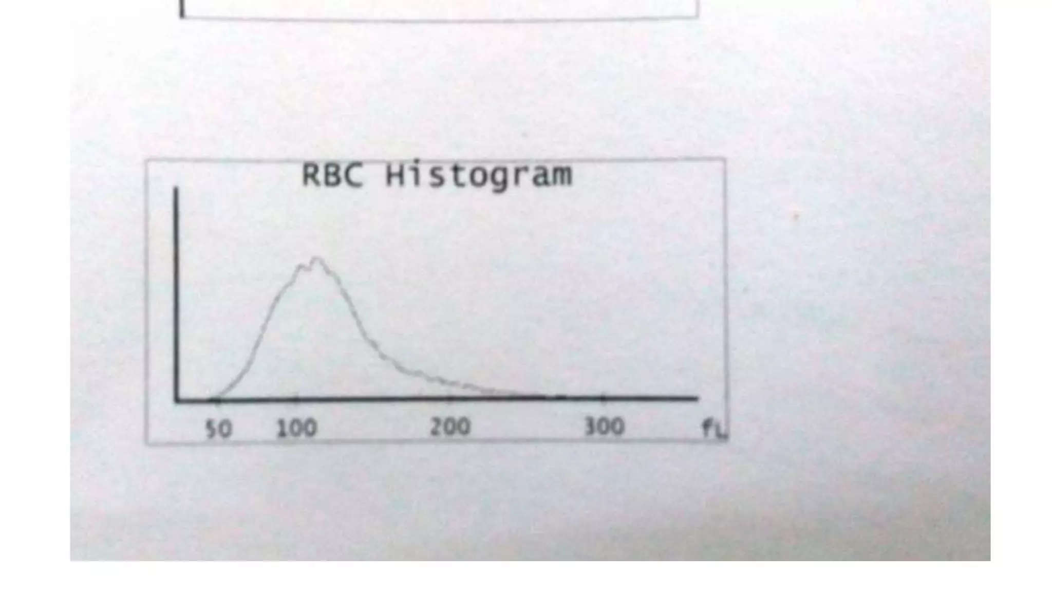 Interpretation of histograms | PPTX