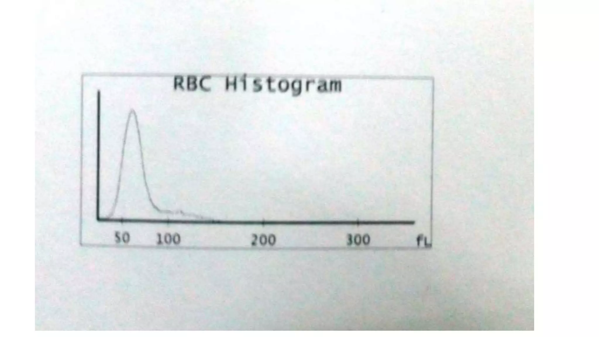 Interpretation of histograms | PPTX