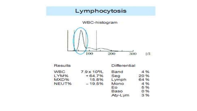 Interpretation of histograms | PPTX
