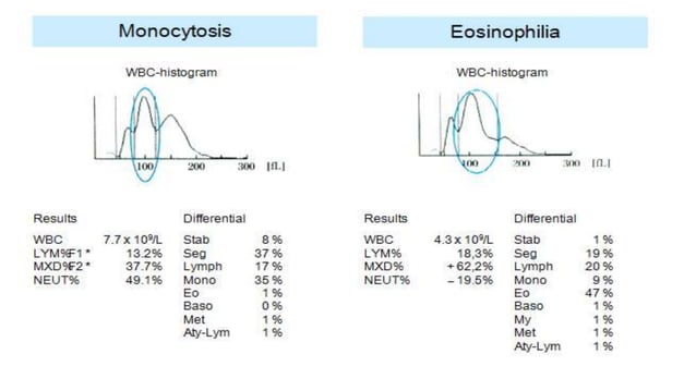 Interpretation of histograms | PPTX