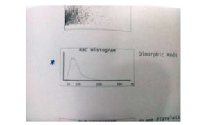 Interpretation of histograms | PPTX