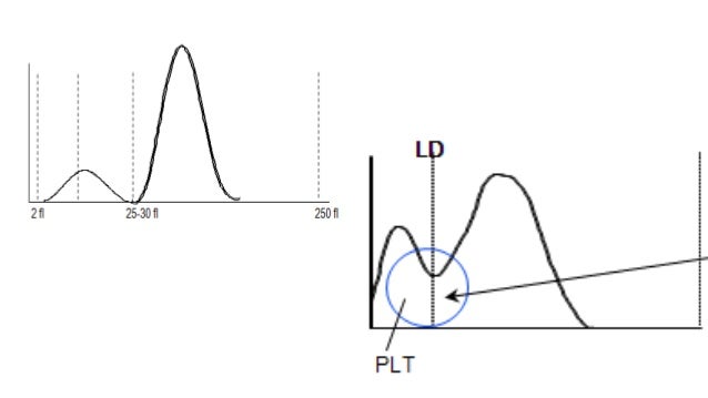 Interpretation of histograms
