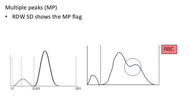 Interpretation of histograms