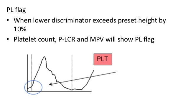 Interpretation of histograms