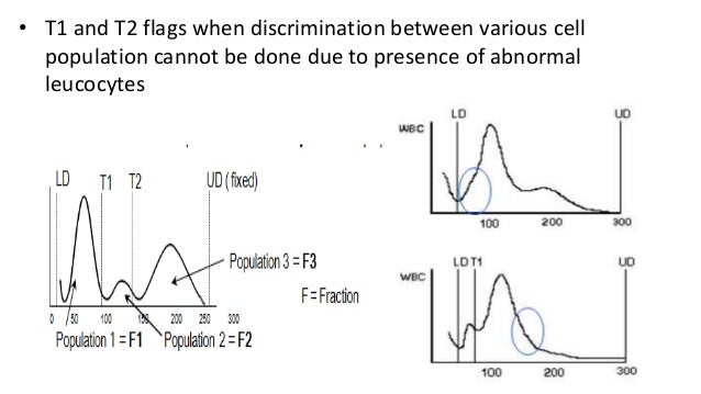 Interpretation of histograms