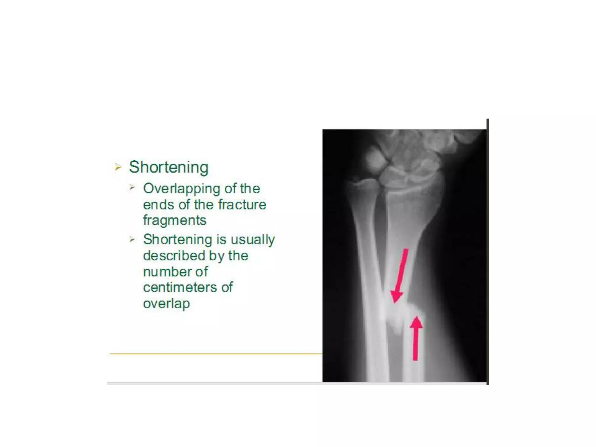 Interpretation of musculoskeletal x rays | PPTX