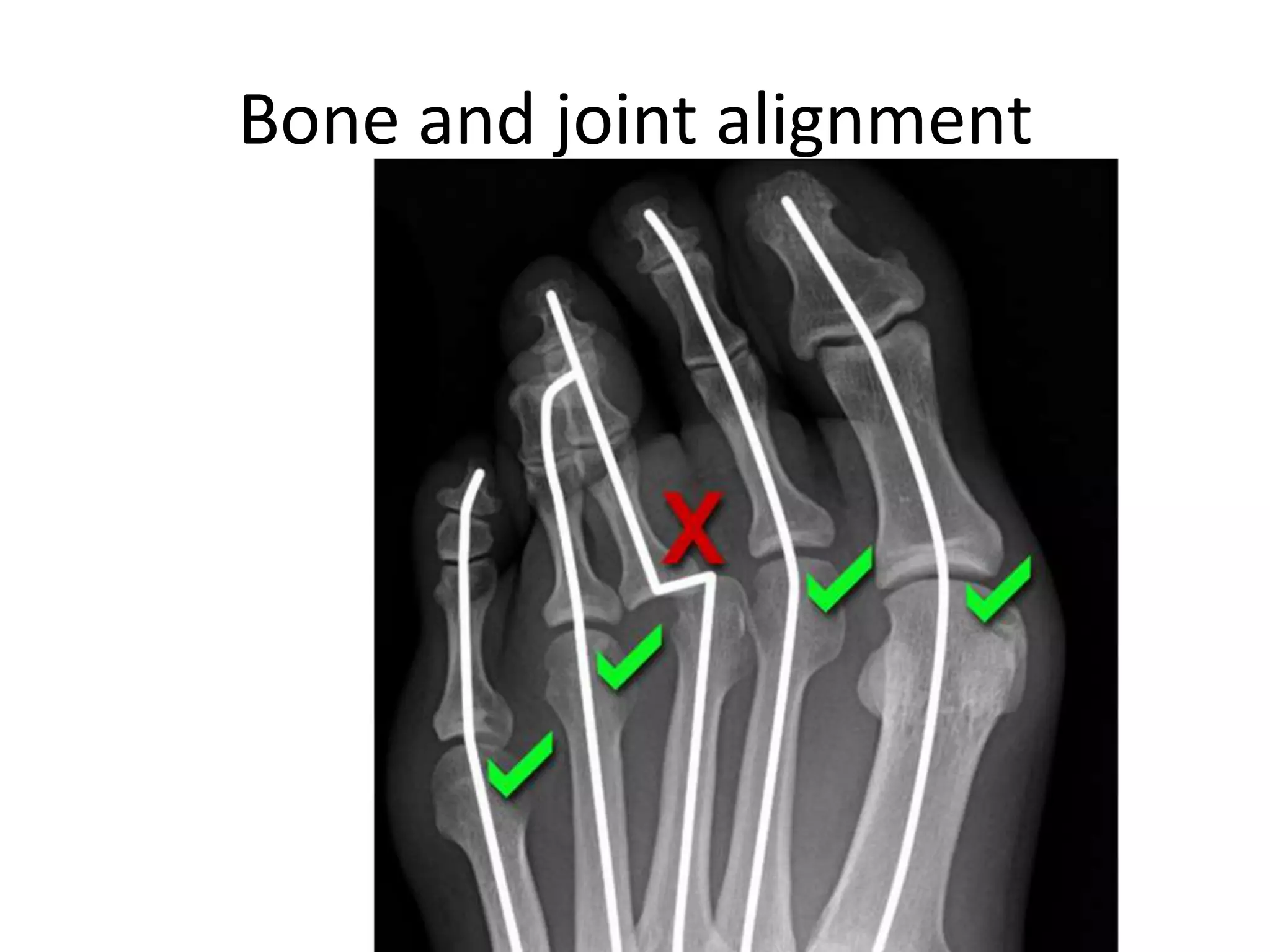 Interpretation of musculoskeletal x rays | PPTX